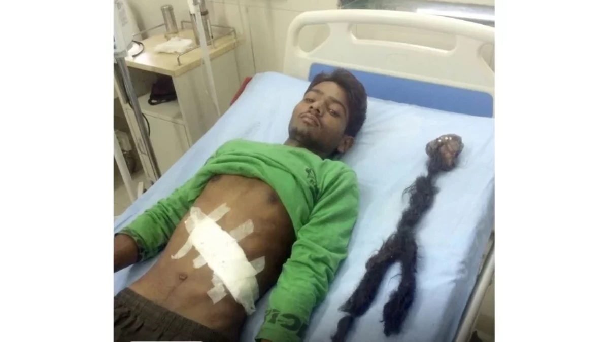 Jovem de 18 anos descobre que carregava o próprio gêmeo dentro do corpo ...